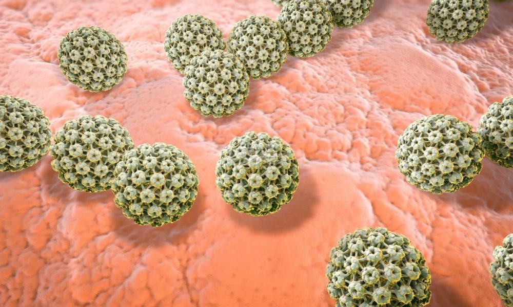 Los métodos de contagio del Virus del Papiloma Humano más comunes